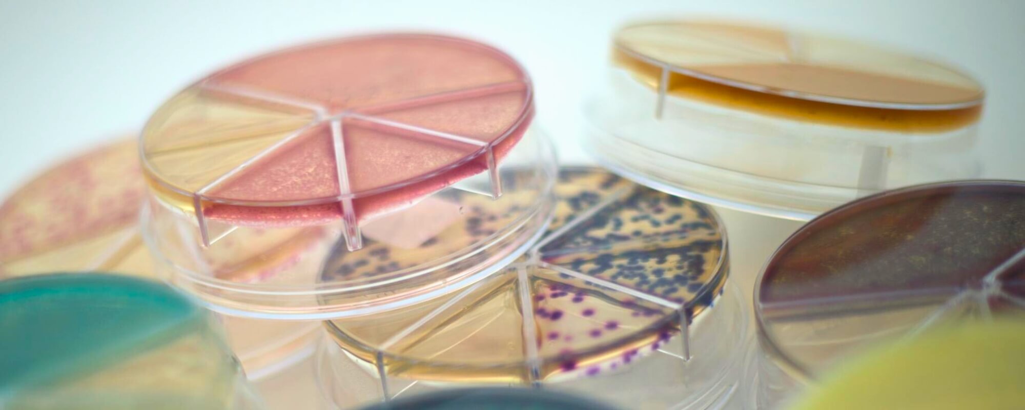 Brug Flexicult Urinkit Korrekt | Hounisens Guide Til Prøvehåndtering